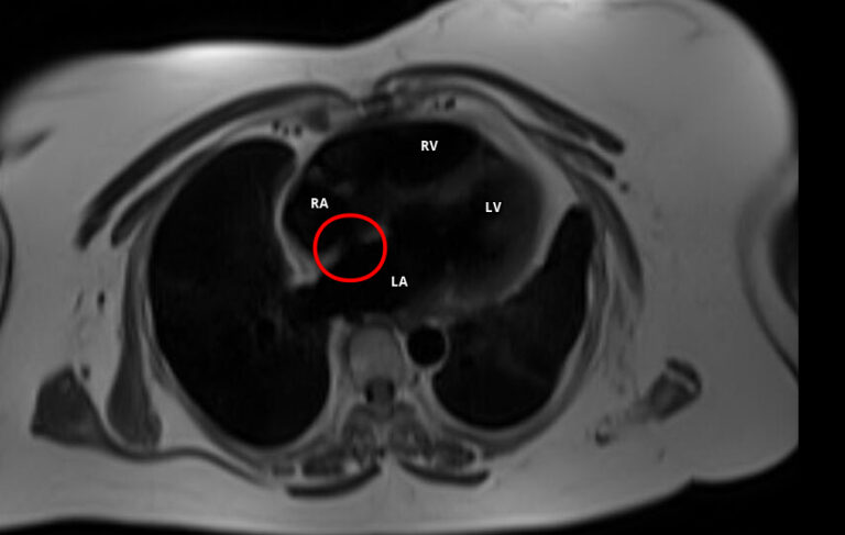 FIT Case of the Month, June 2018: Anezi Uzendu, MD – Ohio-ACC